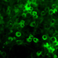 NSE, Neuron-Specific Enolase or ENO 2 Antibody