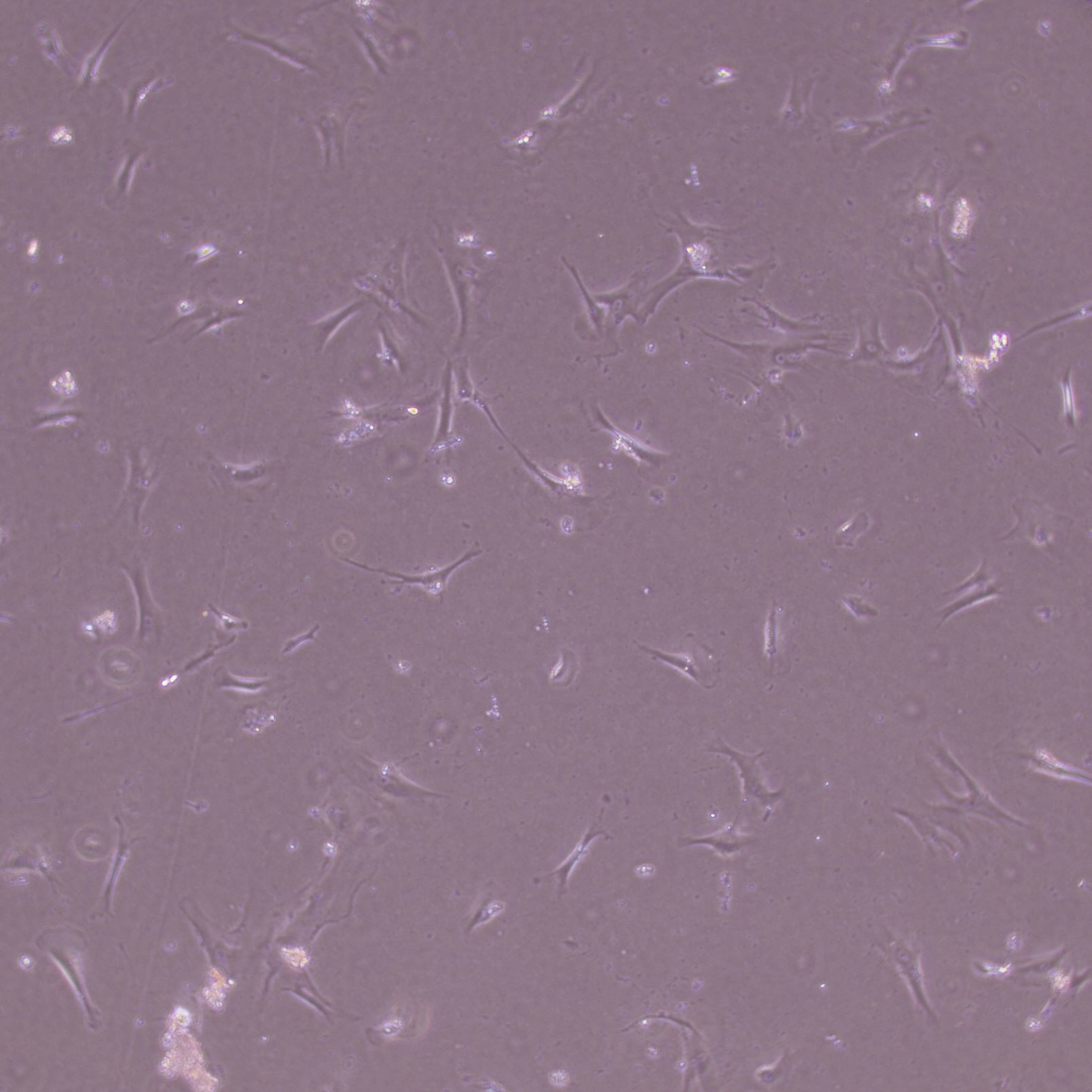 Human Schwann Cell Data